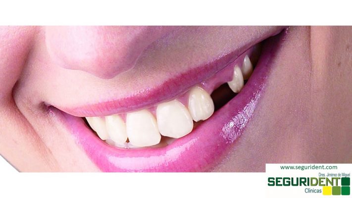 Despre cele mai bune tratamente pentru gingiile sensibile am vorbit ...